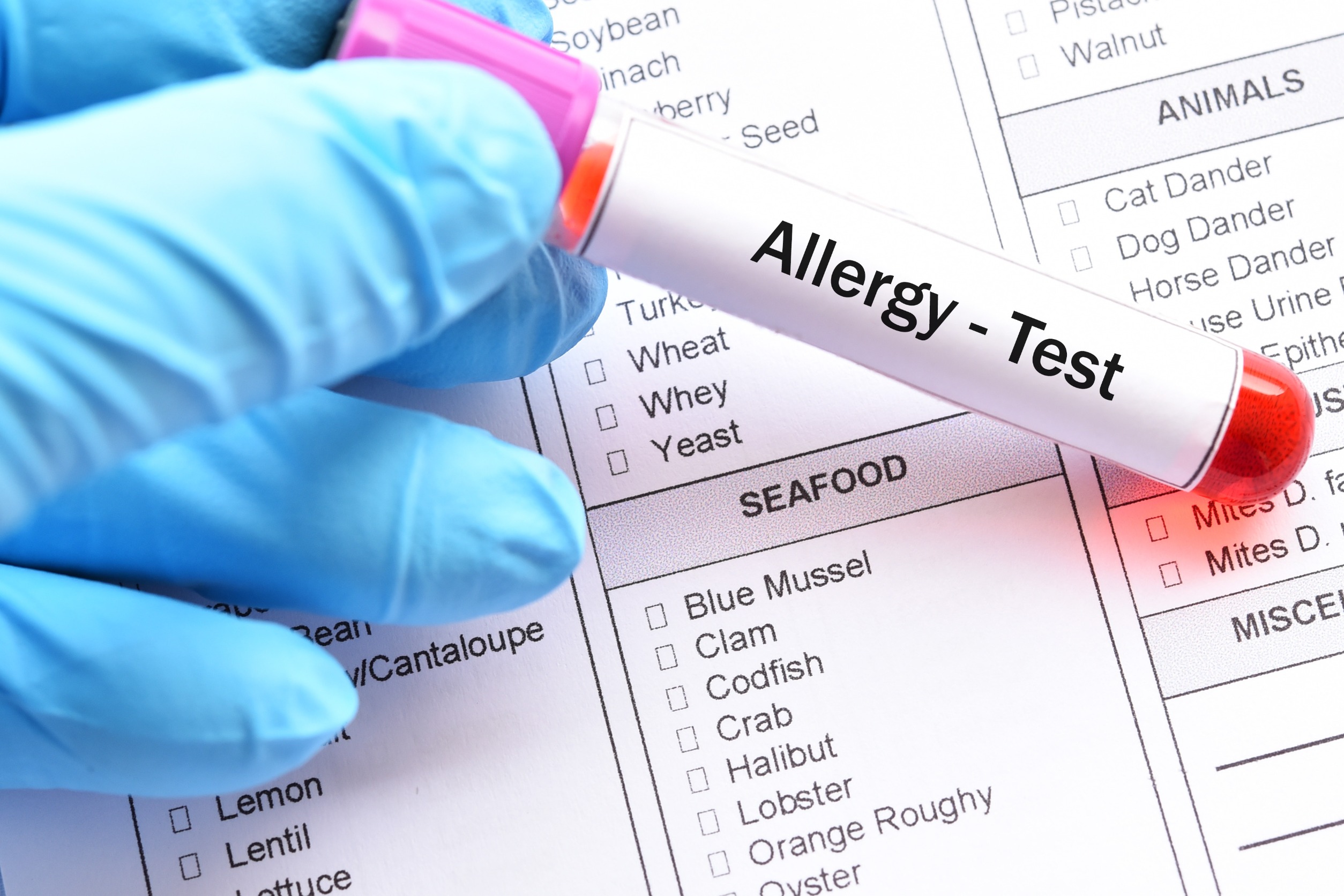 Why Should You Do Allergy Testing for Your Patient? - Clarity Labs